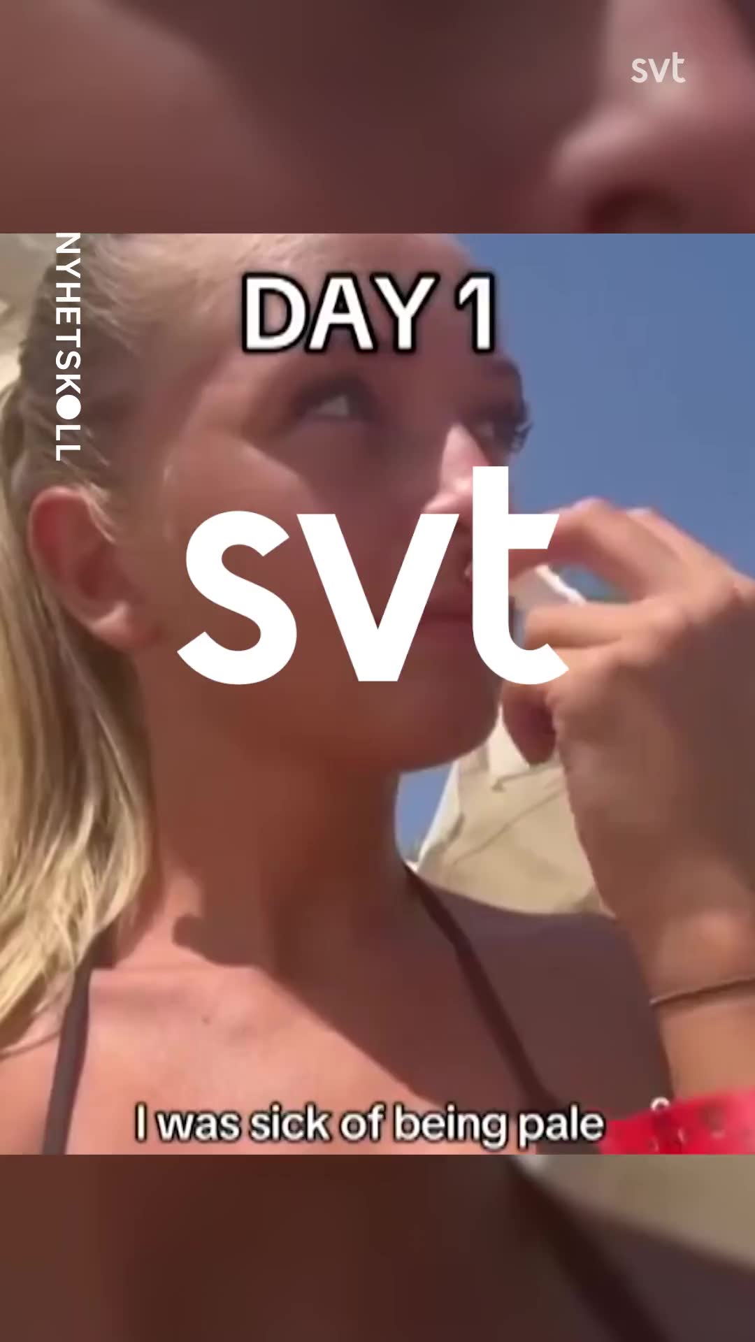 Jonna Lundell inlagd: Det här är sepsis | SVT Nyheter